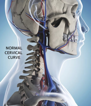 Reverse Cervical Curve - Charlotte Chiropractic Center, PLLC